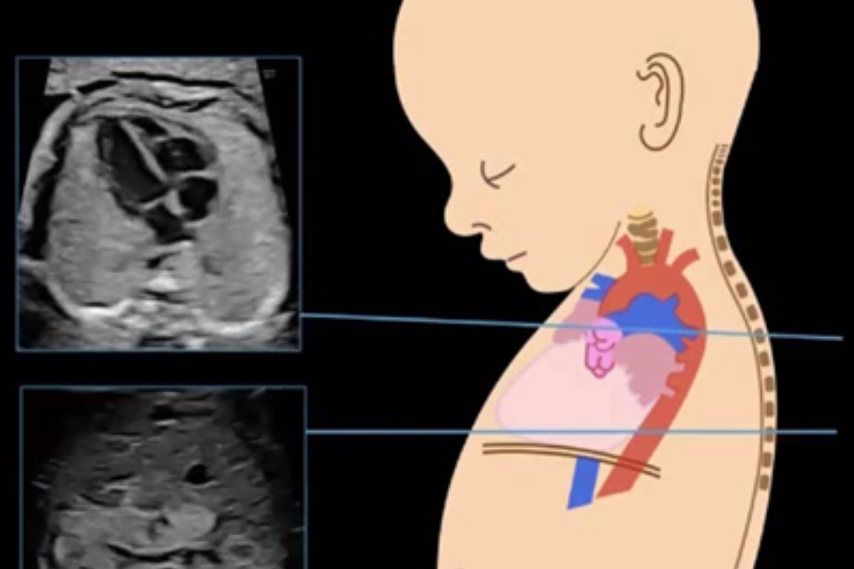 Echocardiography & ECG - Universal Advanced Diagnostics